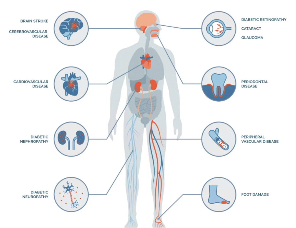 JSNA Diabetes - Gibraltar Health Authority